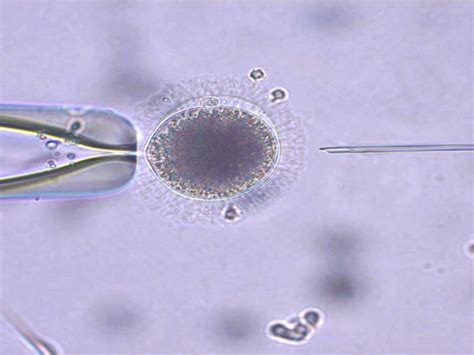 علائم تخمک گذاری که هر خانم بهتر است بداند نیمه شب