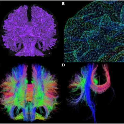 Whole Brain Fiber Tractography Obtained Via The Shell Seeding Option Download Scientific