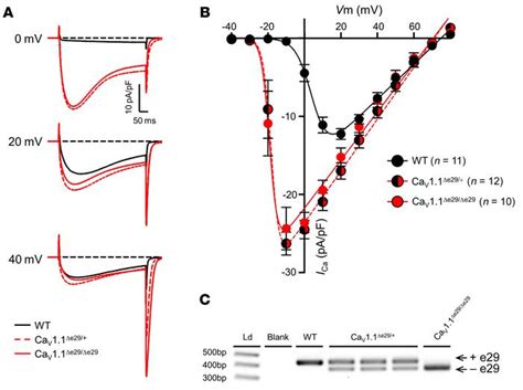 JCI Verapamil Mitigates Chloride And Calcium Bi Channelopathy In A