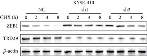 Influence Of Trim9 On Zeb1 Degradation Velocity In Kyse 410 Cells