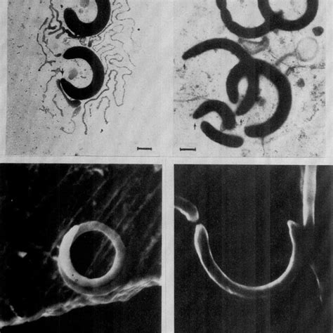 Transmission Electron Micrographs Of Negatively Stained Cells A And B