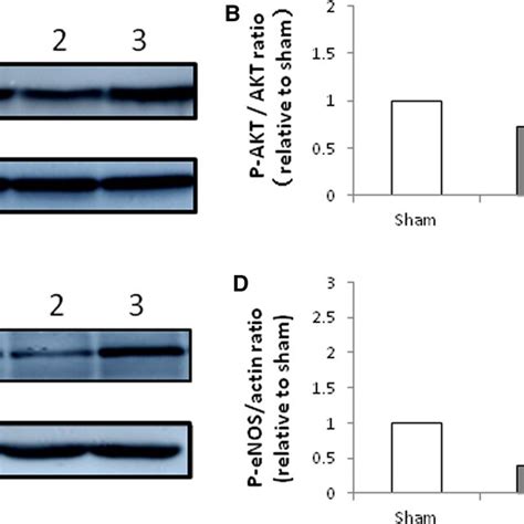 Effects Of Ursolic Acid On Phosphorylation Levels Of Akt And Enos