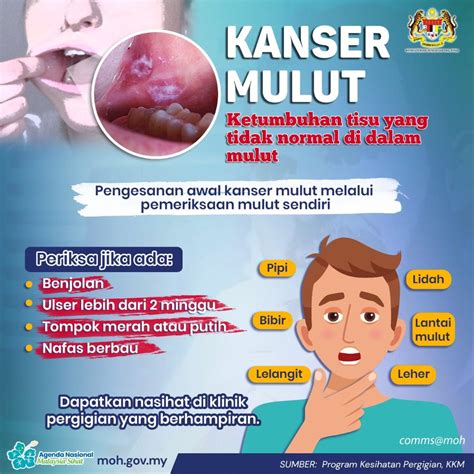 National Cancer Society Of Malaysia Penang Branch Kanser Mulut
