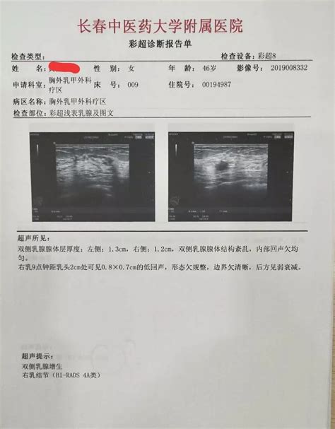 BIRADS分类4a是什么意思你知道吗 乳腺