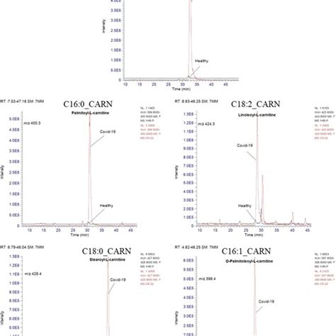 Representative Overlayed Ms Extracted Ion Chromatograms Of