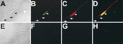 Cd44 Partially Colocalizes With Erbb2 In Schwann Cells In Vitro