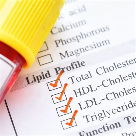 Lipid Profile Test In Dubai American Medical Center
