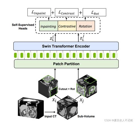 Cvpr2022 用于 3d 医学图像分析的 Swin Transformers 的自监督预训练self Supervised Pre