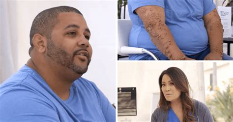 Dr Pimple Popper Season 8 Can Dr Lee Treat Roberts Eruptive