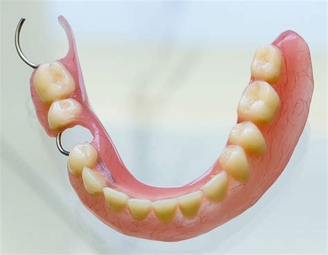 Immediate Dentures For Right After Extractions Surgery Grantham Denture Clinic