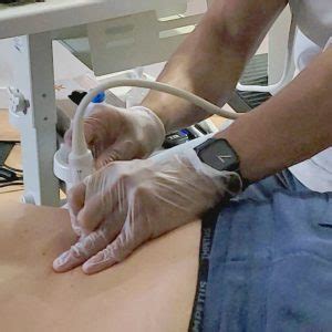 Fisioterapia invasiva del neuroeje Valoración y tratamiento en el