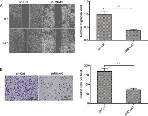 Knockdown Of Snhg16 Suppresses Migration And Invasion Of Pc Cellsa