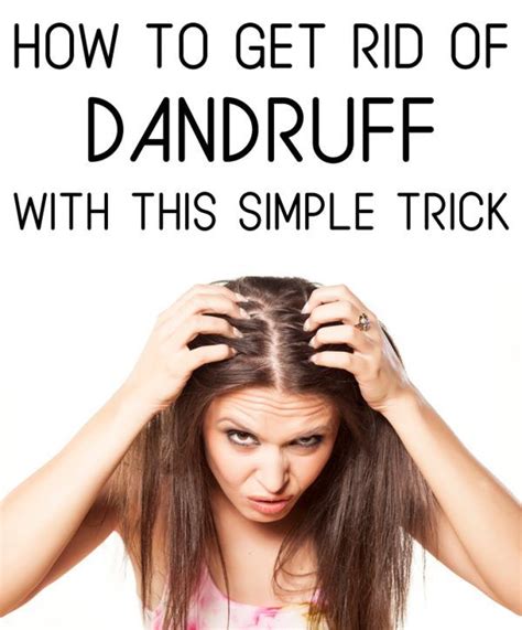 How To Get Rid Of Dandruff Permanently Curly Hair Best Simple