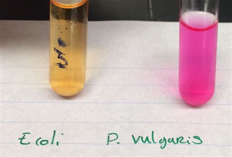 Proteus Spp Microbiology Laboratory Turkey