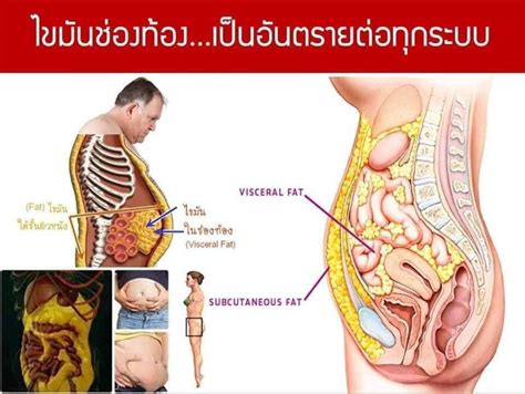 🔥visceral Fat คืออะไร กาแฟลดน้ำหนัก คาเฟ่ 7 เลก้า