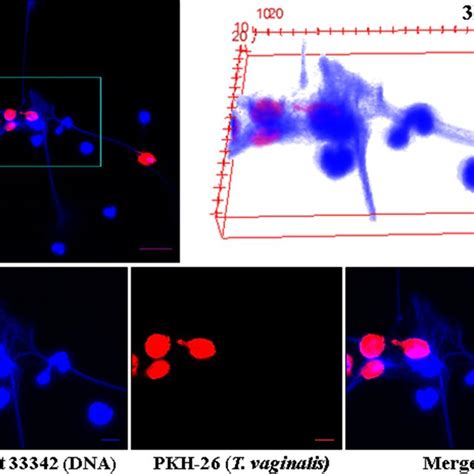 Immune Detection Of Human Myeloperoxidase In Neutrophils And Nets Download Scientific Diagram