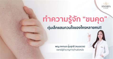 ขนคุด เกิดจากอะไร รักษาอย่างไรให้ผิวกลับมาเรียบเนียน