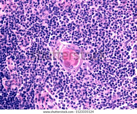 Light Microscope Micrograph Thymus Medulla Showing库存照片1523335124