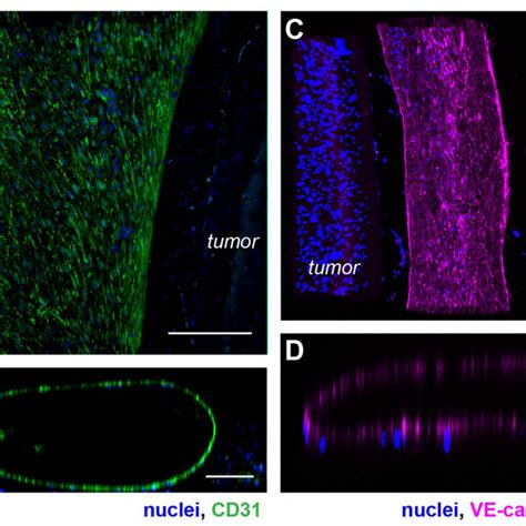 Angiogenesis In A Hypoxic Skov3 Tumor Model A A Vascular Segment