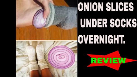 WHAT HAPPENS WHEN YOU PUT ONIONS UNDER THE FEET REMOVE TOXINS YouTube