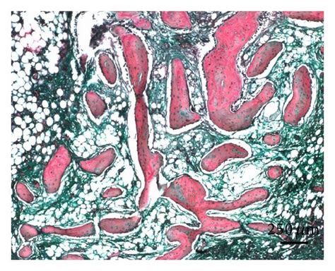 Histological Cross Sections 4 μm After Infection With Mrsa 40x A