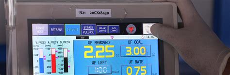Undergoing Dialysis Know How Nutrition And Diet Help