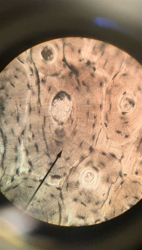 What Is Bone Tissue