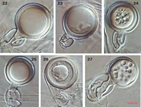 Phytophthora Niederhauserii Gametangia And Oospores Sexual Stage Download Scientific