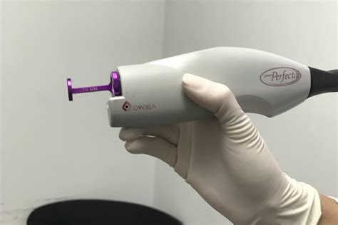 How To Get Rid Of Acne With Lasers Popsugar Beauty