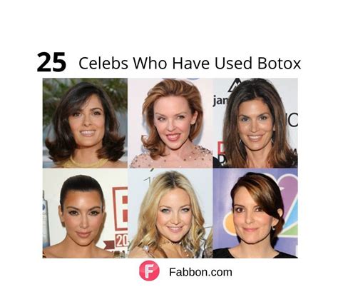 Celebrity Botox Before And After