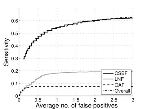froc curve on the jsrt database three curves indicate the performance
