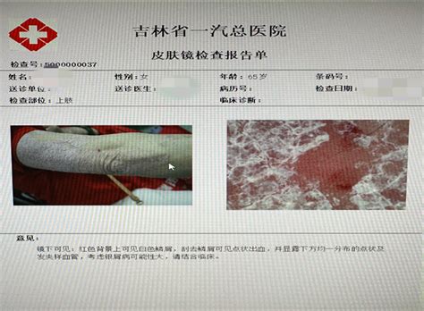 吉林省一汽总医院官网