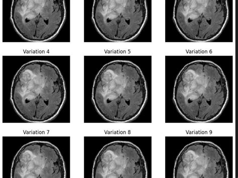 Image Classification Machine Learning Cnn Computer Vision In Python