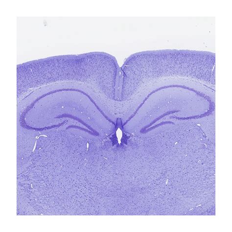 Cresyl Violet Acetate Certified Polysciences Inc