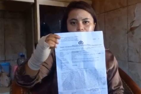 Tolak Bersetubuh Dengan Pria Wanita Cantik Di Surabaya Dianiaya Kekasih Hingga Lebam