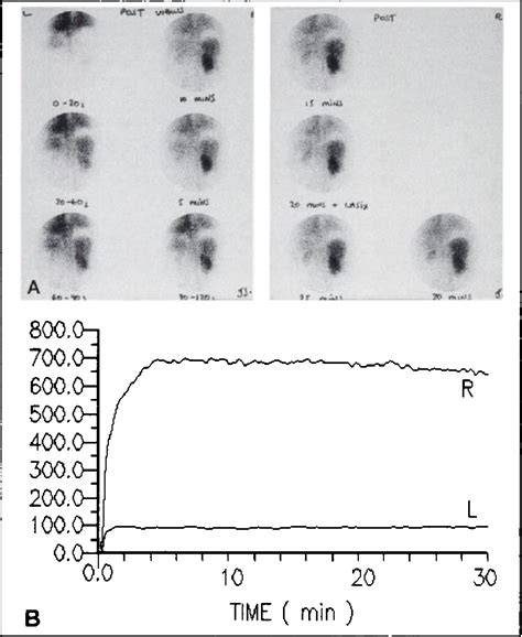 Figure 1 From Validation Of Renal Output Efficiency As An Objective