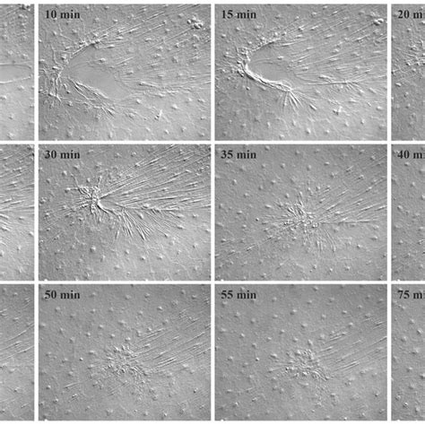 Pdf An Orientation Independent Dic Microscope Allows High Resolution