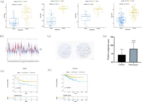 Slc14a1 Gene Is Differentially Expressed In Pca And Other Cancers And