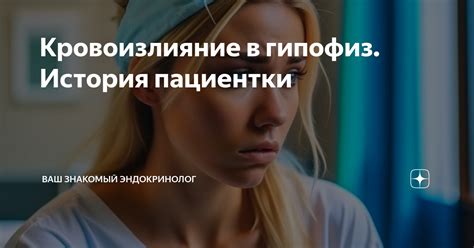 Кровоизлияние в гипофиз История пациентки Ваш знакомый эндокринолог