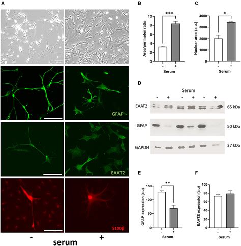 A Convenient Model Of Serum Induced Reactivity Of Human Astrocytes To