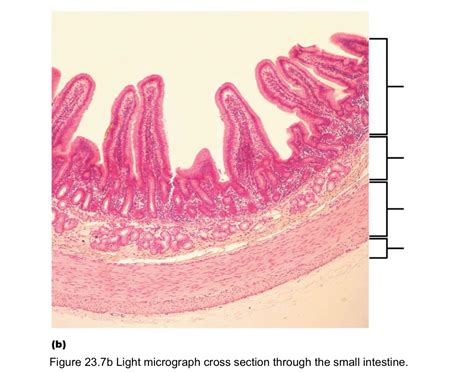 Micrograph Cross Section Of Small Intestine Quiz