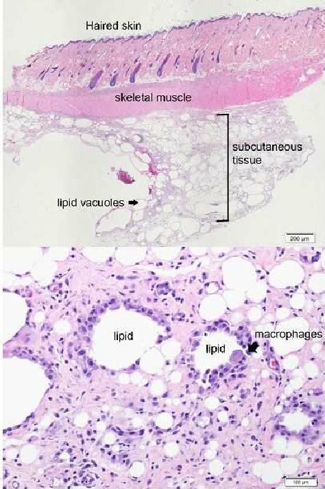 Histological Analyses Of Skin Lesions From Rats Injected With Reagent
