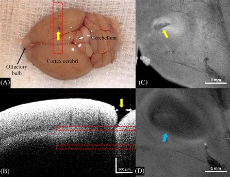 Hippocampus Anatomy Mouse