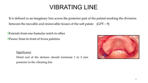 Anatomical Landmarks And Primary Impression Pptx