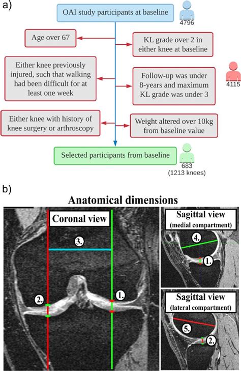 Two Stage Classification Of Future Knee Osteoarthritis Severity After 8 Years Using Mri Data