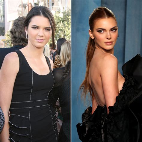 Kendall Jenner Before And After How Much Do You Think Shes Improved