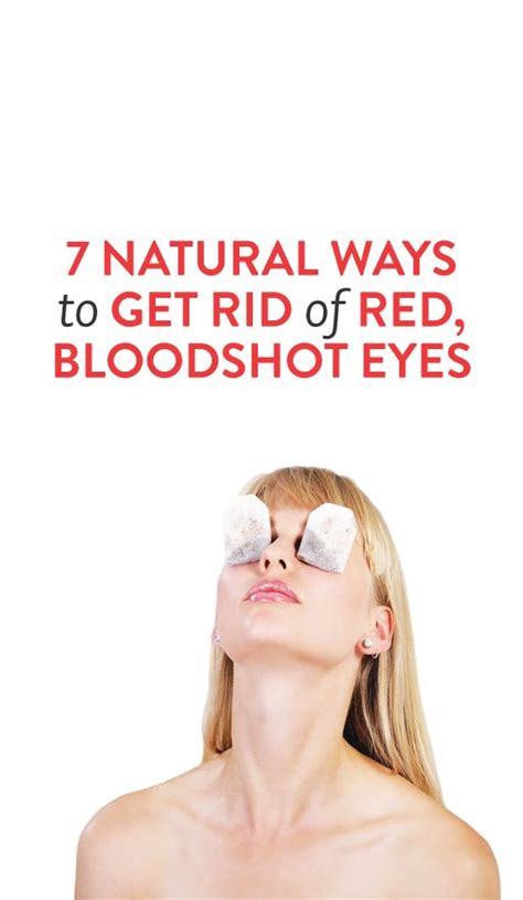 Fitness Club 7 Natural Ways To Get Rid Of Red Bloodshot Eyes