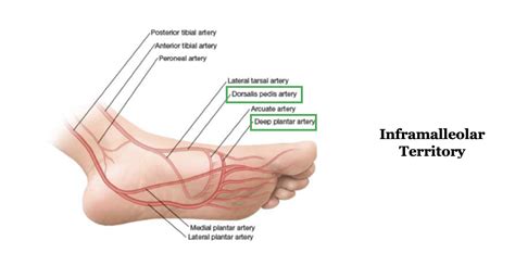 2026 Cpt Updates New Vascular Territory For Endovascular Revascularization Of Lower