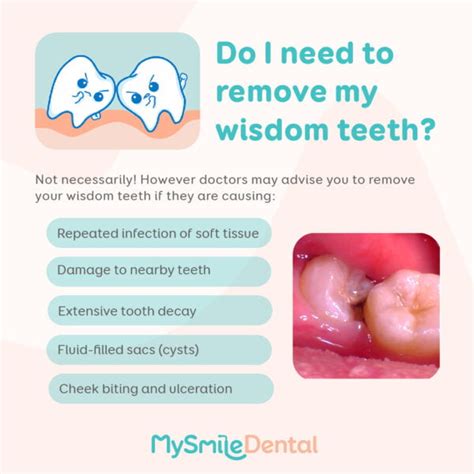 Do I Need To Remove My Wisdom Teeth Mysmile Dental Clinic