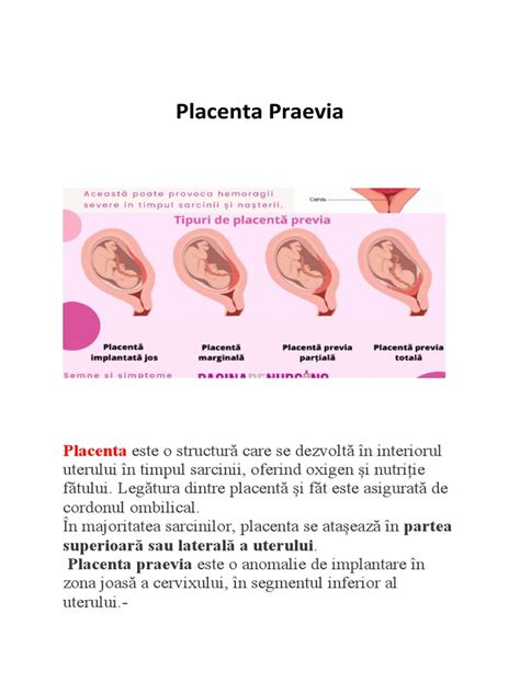 Placenta Praevia Pdf
